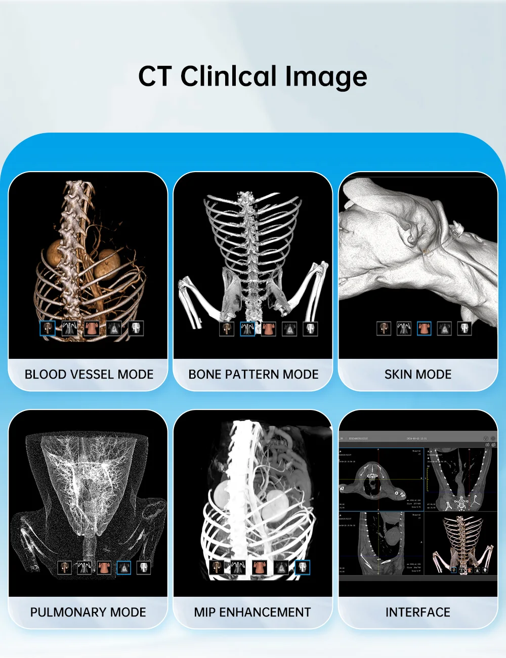Veterinary CT Scan Machine | Cat & Dog Radiology RD Equipment | Pet CT ...