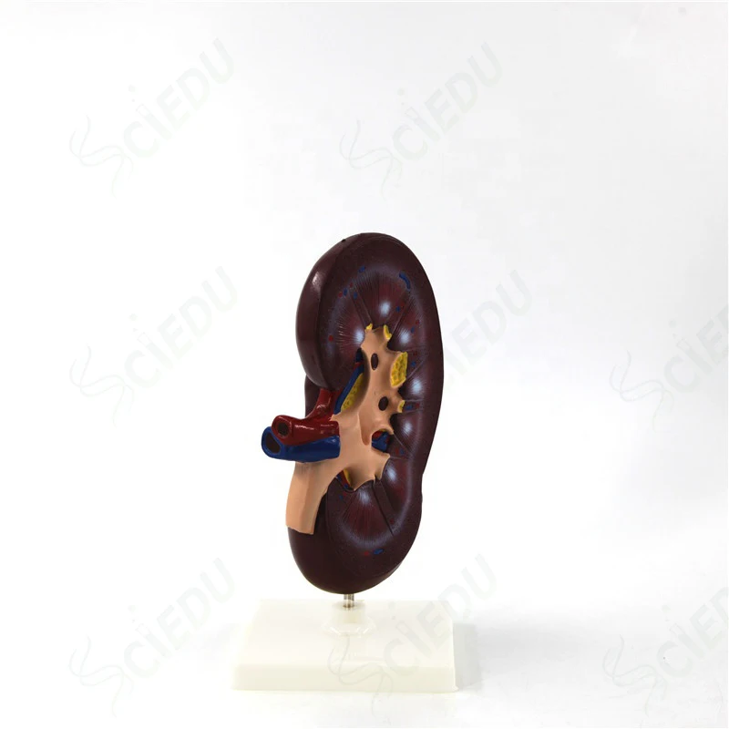 Medical Science Anatomy Kidney Model Teaching Resource Aids Anatomy ...