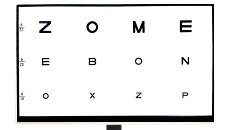 Ophthalmic Chart Projector 23.5 Inch Eye Test Vision Chart Projector ...