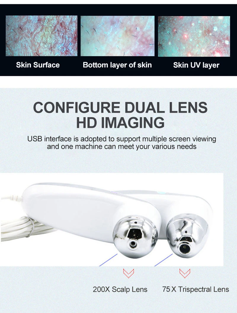 MEIBOYI Skin Analysis Camera - Advanced Scalp Analyzer