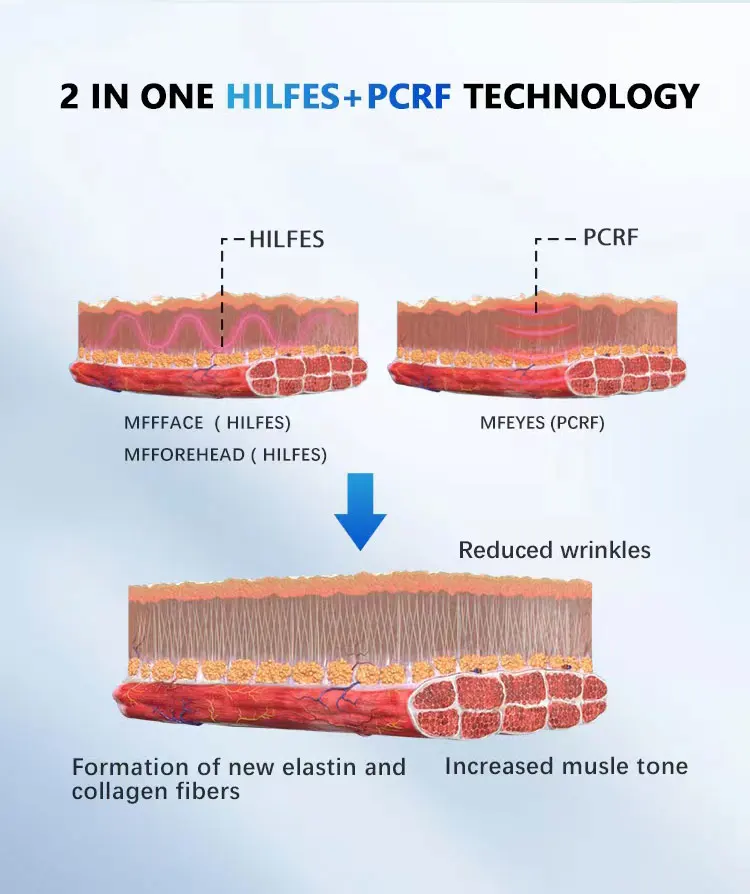 Rf Toning Facial Muscle Stimulator Machine Mffface For Face Lifting ...