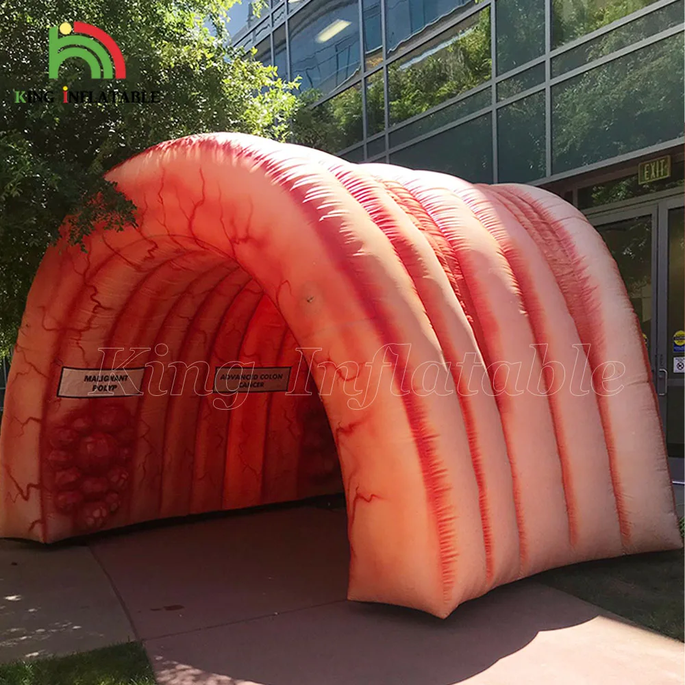 Inflatable Colon - Medical Educational Tool for Cancer Awareness
