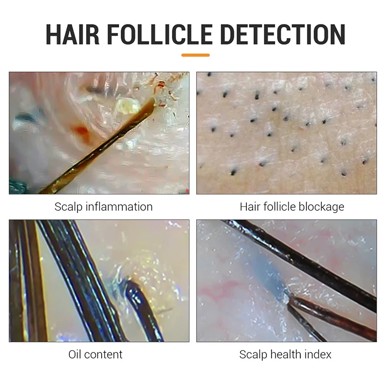 Portable HD Hair Follicles Scalp Scanner Detector Hair Analyzer / Skin ...