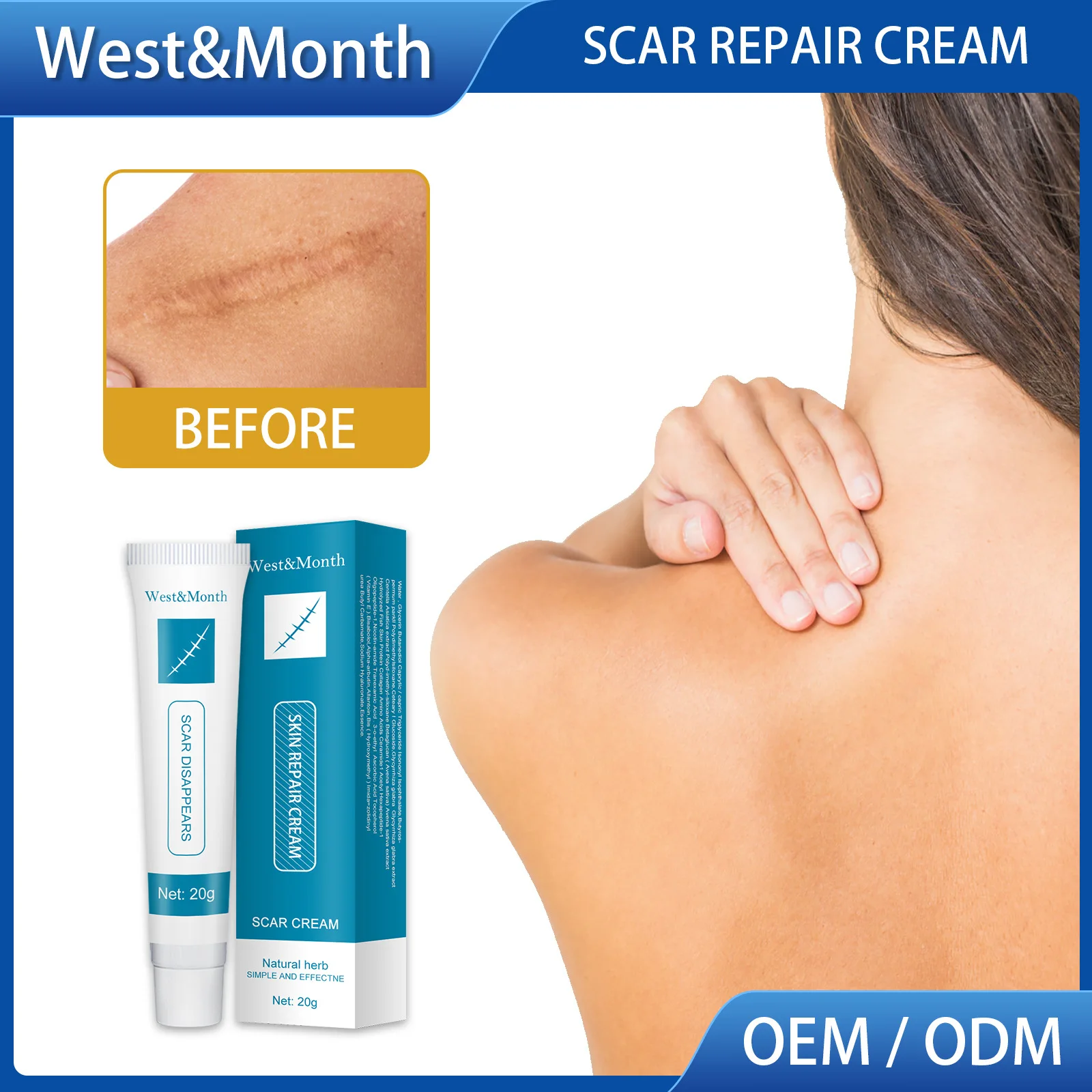 OEM Scar Removal Cream Pimples Stretch Marks Face Remove Acne Smoothing ...