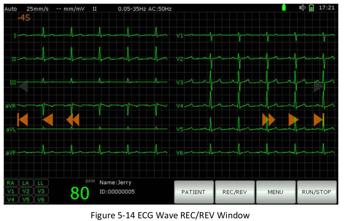 Portable Pet ECG Machine - VET ECG Equipment for Animals