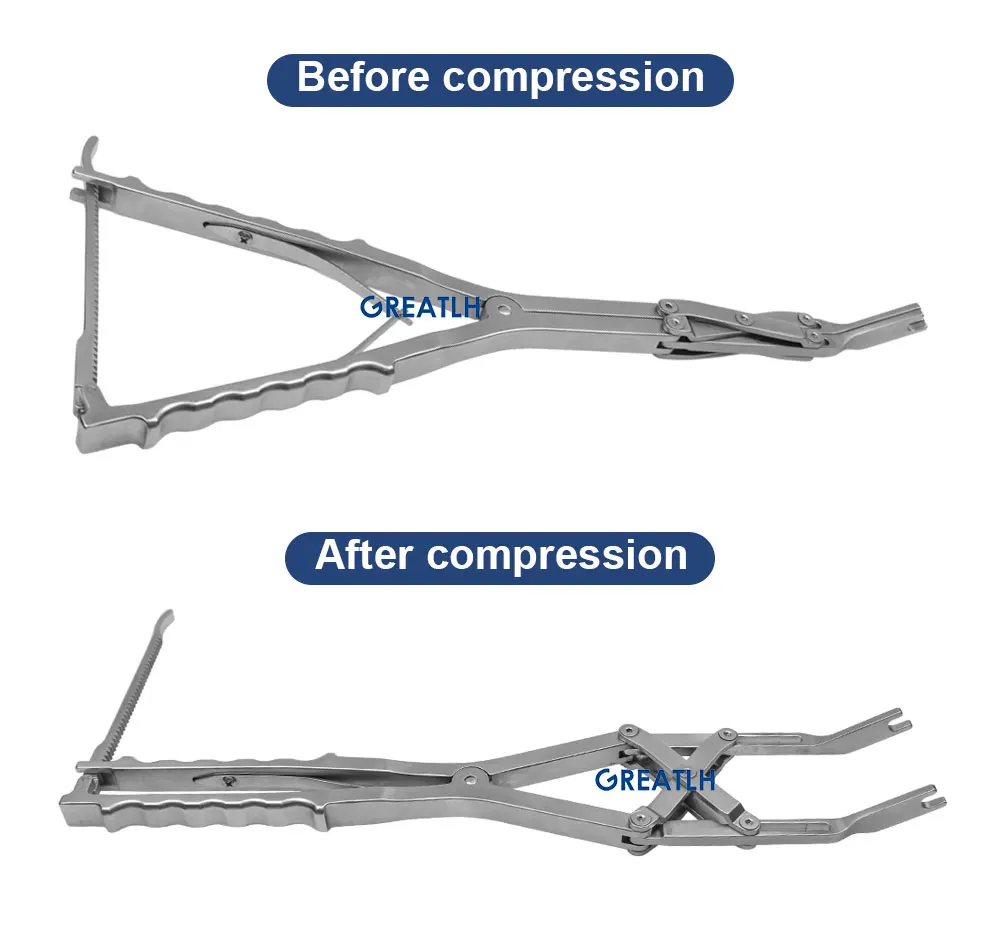 Medical Supplies Orthopedic Surgical Instrument Surgical Forceps ...