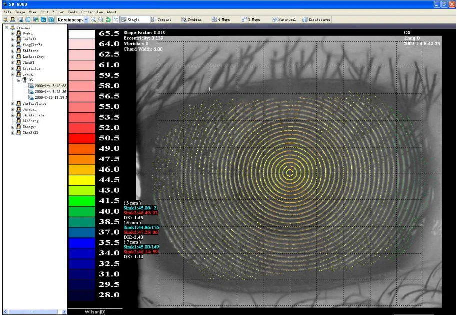 Surgery Corneal Mapping System Ophthalmic Topographer Equipment for ...