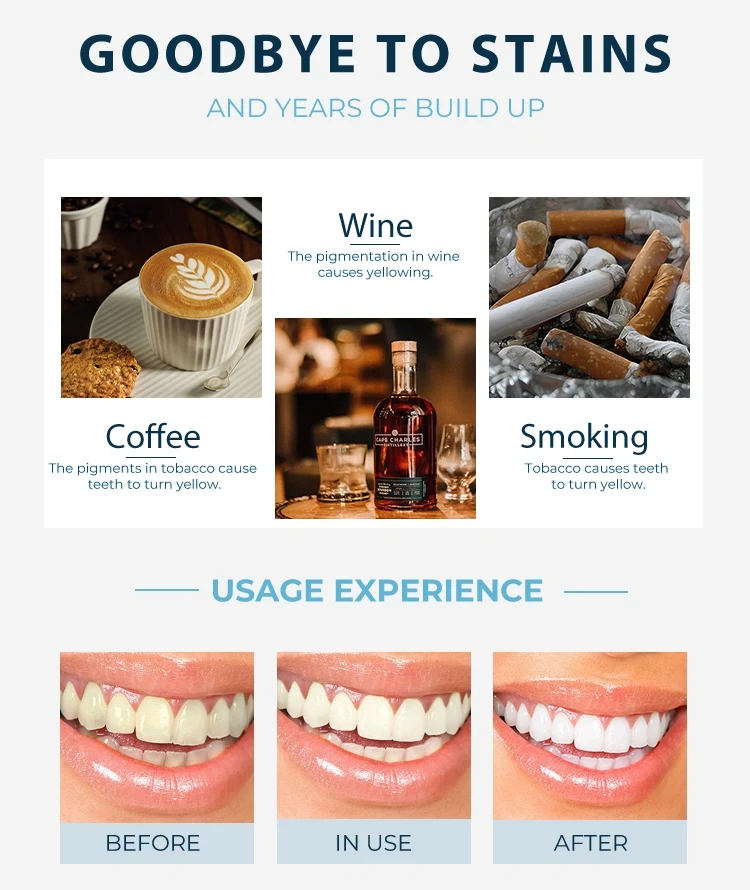 Wholesale Professional Whitening Tooth Dry Private Label White Strips ...