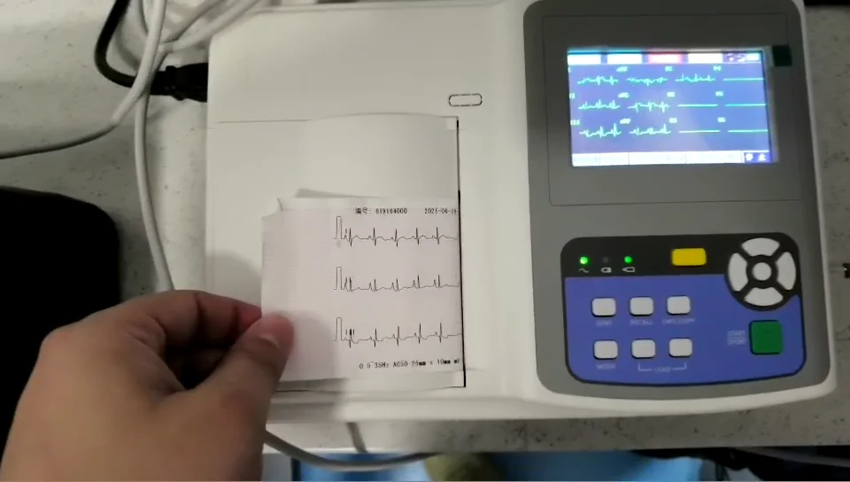 Vec8003v 3 Channel Vet Portable Mini Veterinary Equipment Ecg For ...