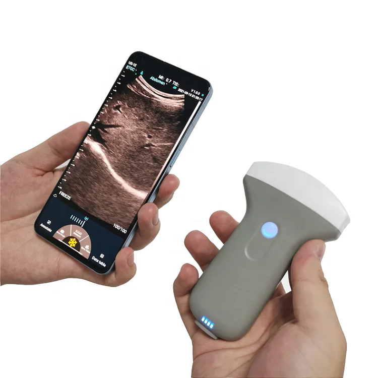Convex Linear USB/Wifi Double Mode Probe Color Ultrasound Scanner Usb ...