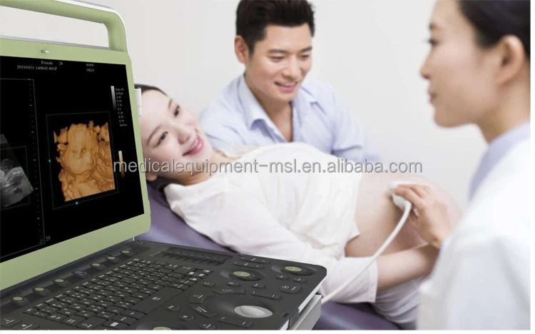 Portable Color Doppler 3D 4D Ultrasound Machine - Full Digital