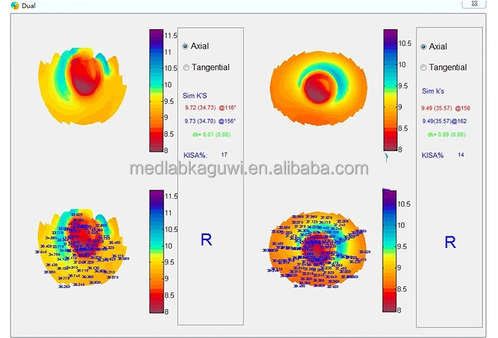 Corneal Topographer - Precision in Optometry & Ophthalmology