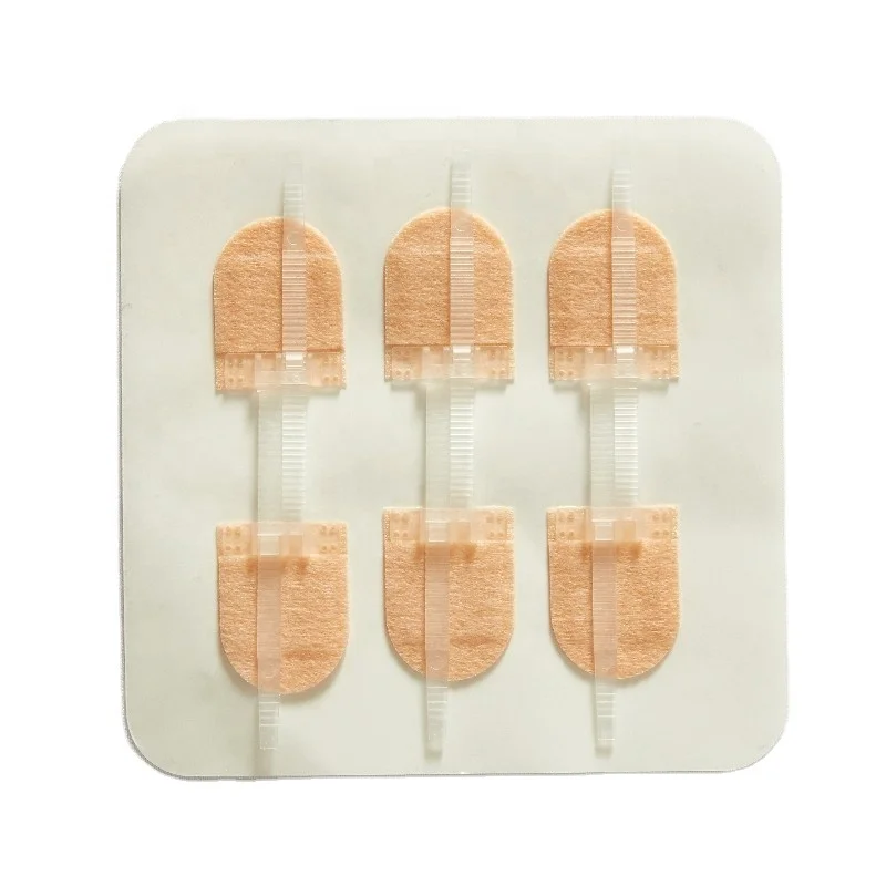 YOJO Hospital Grade Butterfly Band aids Extra Large Zip Stitch Wound ...