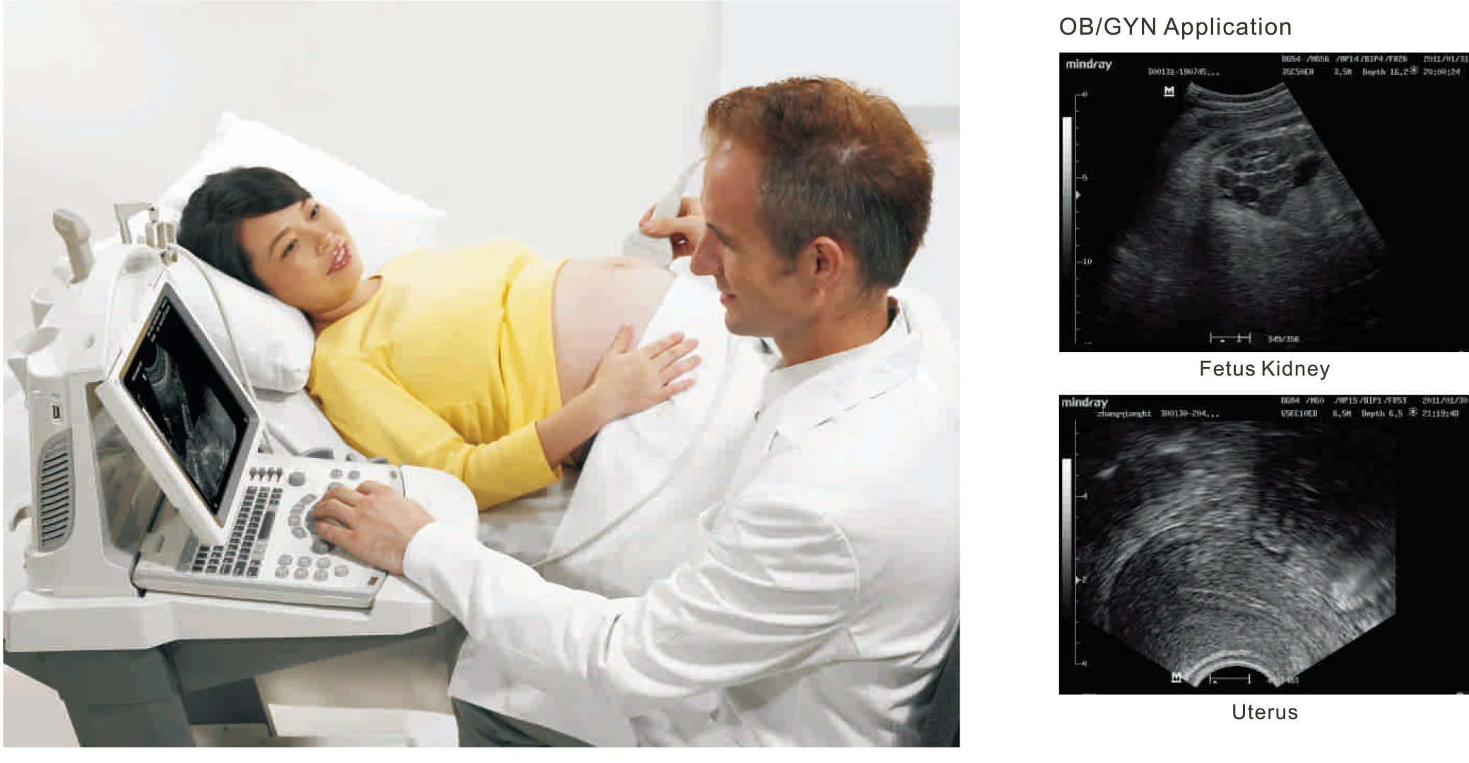 Mindray Dp30 Portable Ultrasound Machine Price / Mindray Dp10 With Pw ...