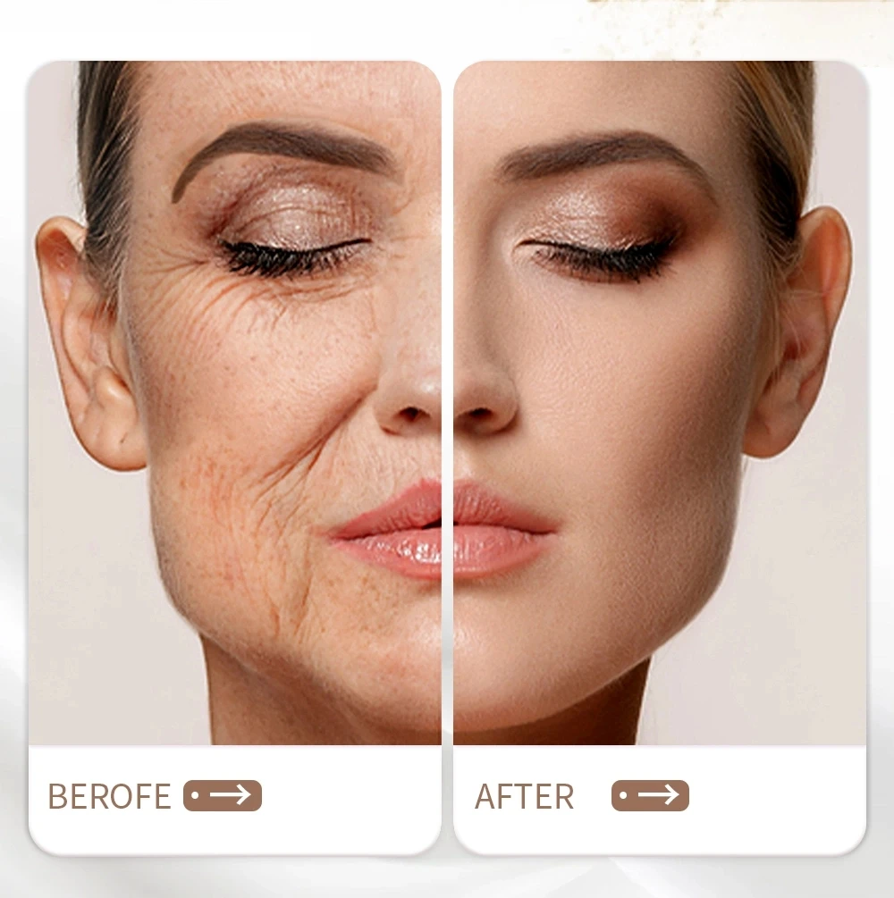 Private Label Whitening Cream Full Set For Dark Skin Anti Aging And ...