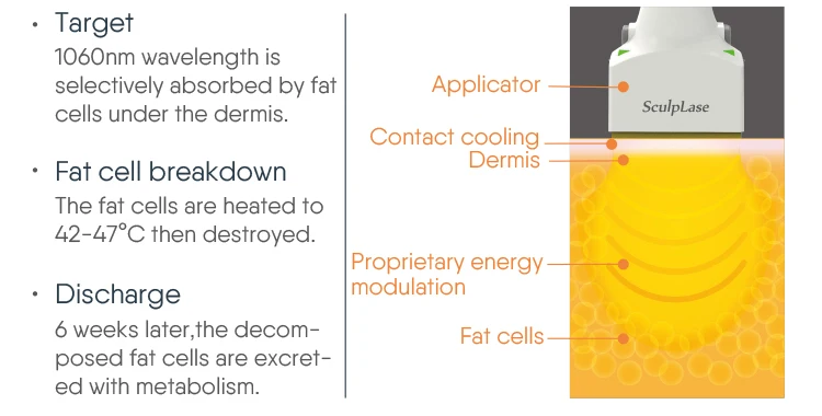 Best Selling Intelligent Operation Laser Weight Loss 1064nm Diode ...