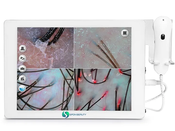 High Quality Hd Hair Follicles Scalp Scanner Detector Hair Analyzer ...