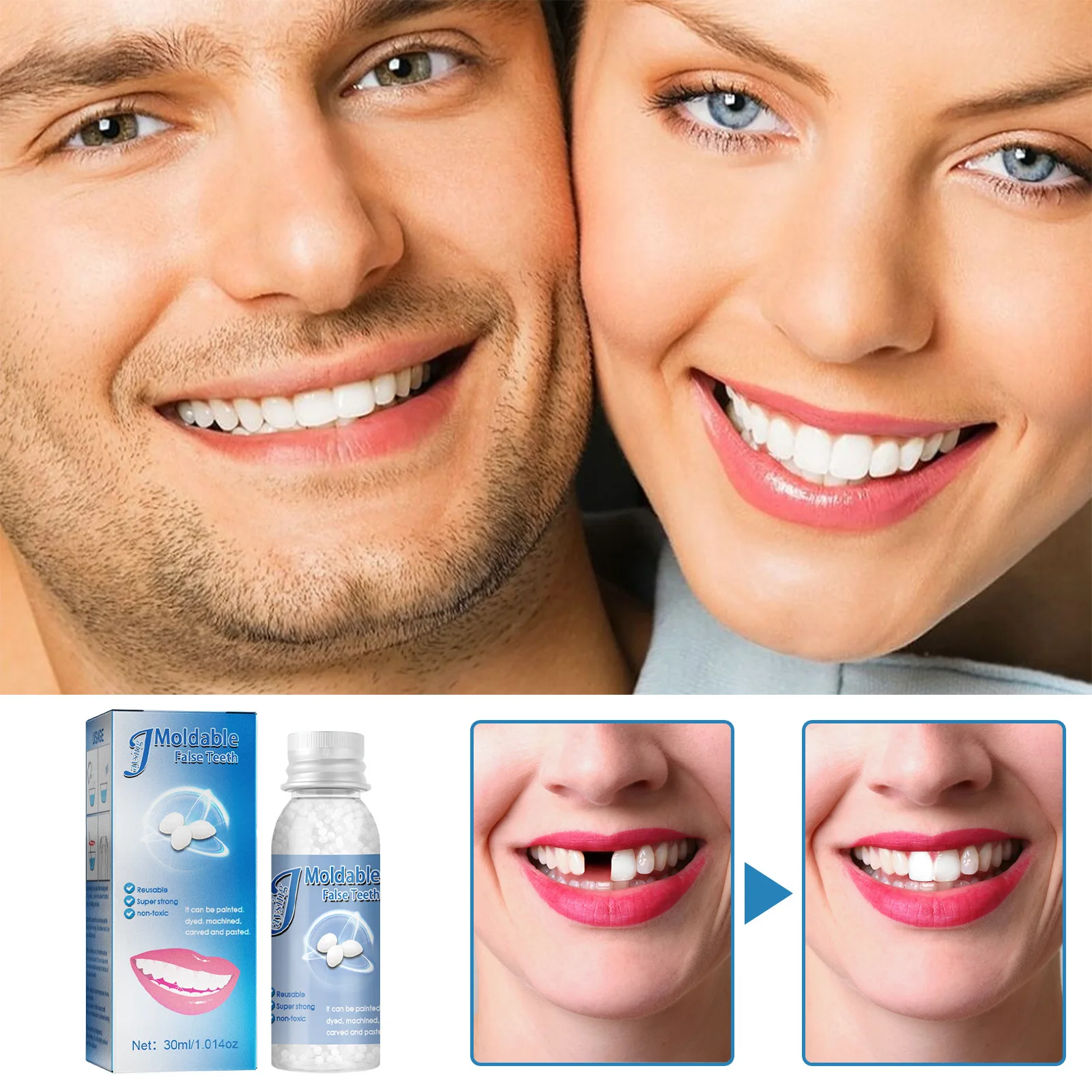 Glue Tooth Temporary Tooth Repair Kit - Moldable Acrylic Resin For ...