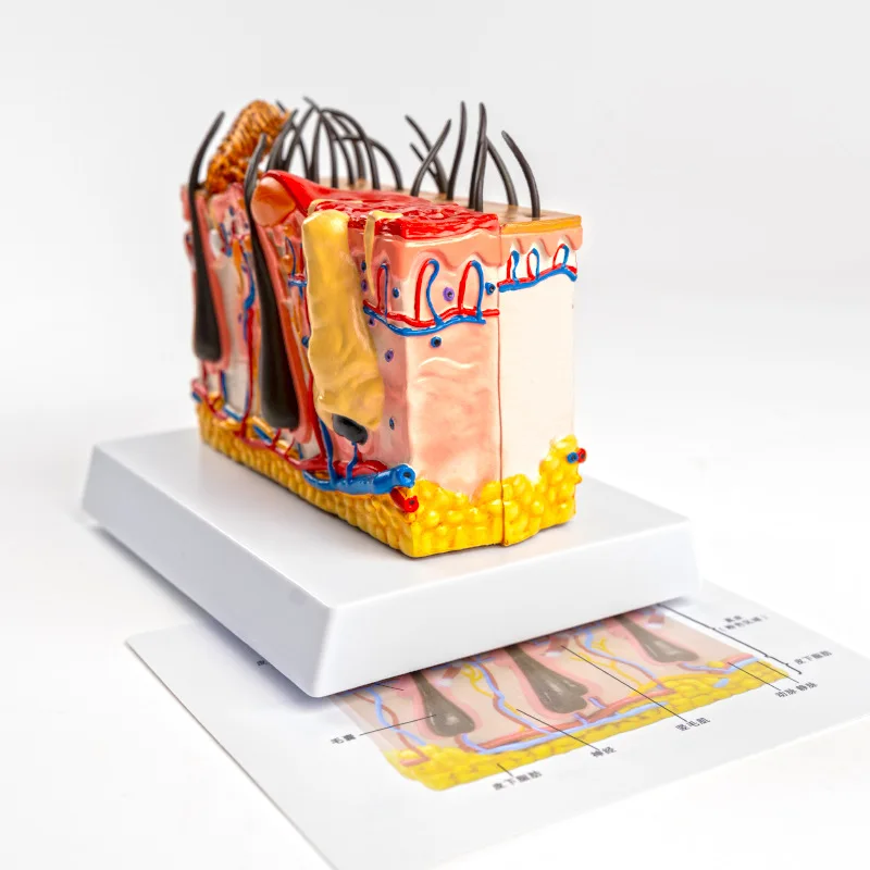 Medical Science Anatomical Model of Pathological Skin Structure in Dogs ...