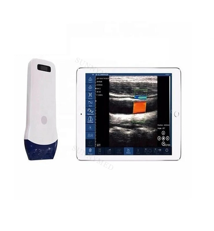 SY-5L Portable Medical Color Doppler Probe Pocket Wireless Wi-Fi ...