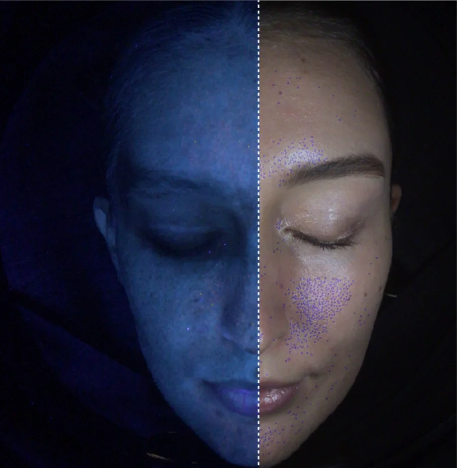 MEICET MC10 Skin Analyzer - Professional Facial Care Tool