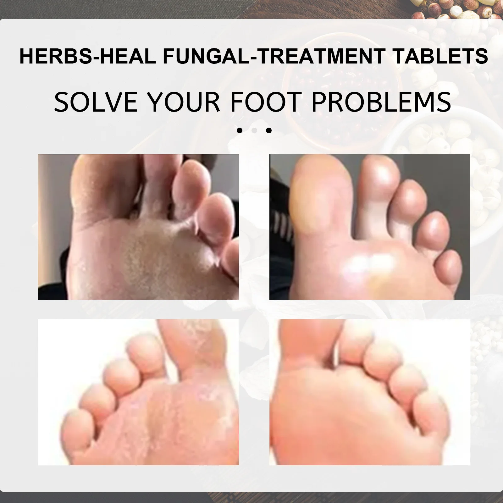 Eelhoe Ginger Anti-fungal Peeling Foot Soak Effervescent Tablets Foot ...