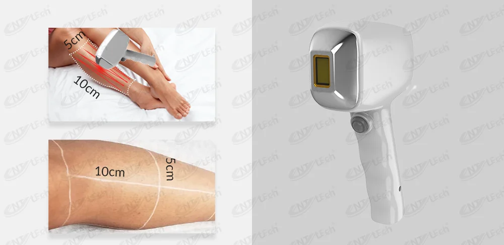 Ce Approved Portable Triple Wavelength Diode Laser Hair Removal 808 Nm ...
