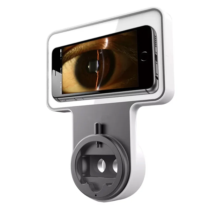Ophthalmology Slit Lamp Topcone Beam Splitter - Customized Support