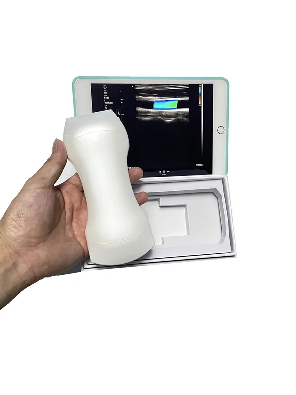 192 Elements Convex Linear Phased Array Color Doppler Ultrasound ...