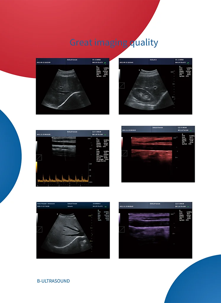 CONTEC Cms600p2plus Portable Doppler for Pulses - 1 Year Warranty