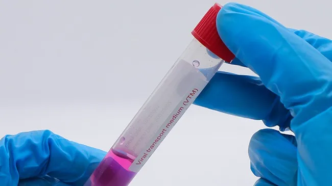 Dna Collection Disposable Sampling Tube Sterile Packaging Packing Tape ...