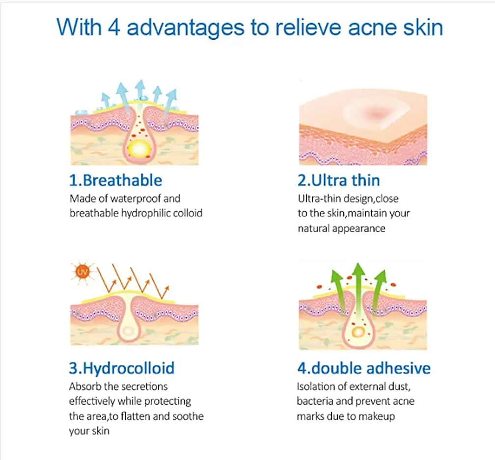 Hydrocolloid Acne Pimple Patches - Effective Spot Treatment
