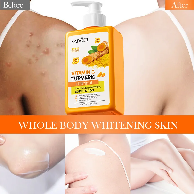 SADOER Vitamin C Turmeric&Retinol Whitening and Brightening Body Lotion ...