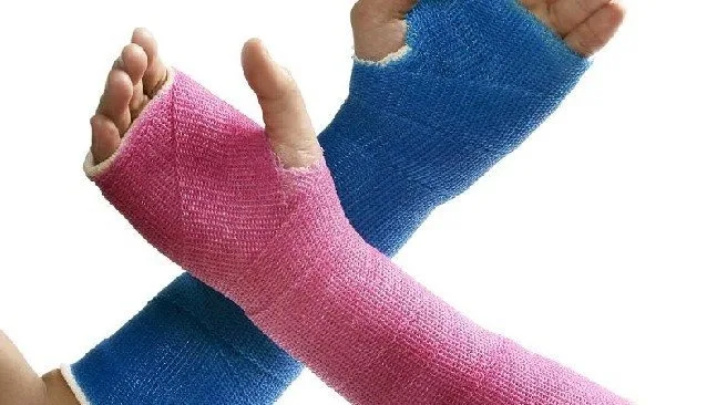 Kangda Medic Orthopedic Fiberglass Casting Tape Bandage Cast Casting ...