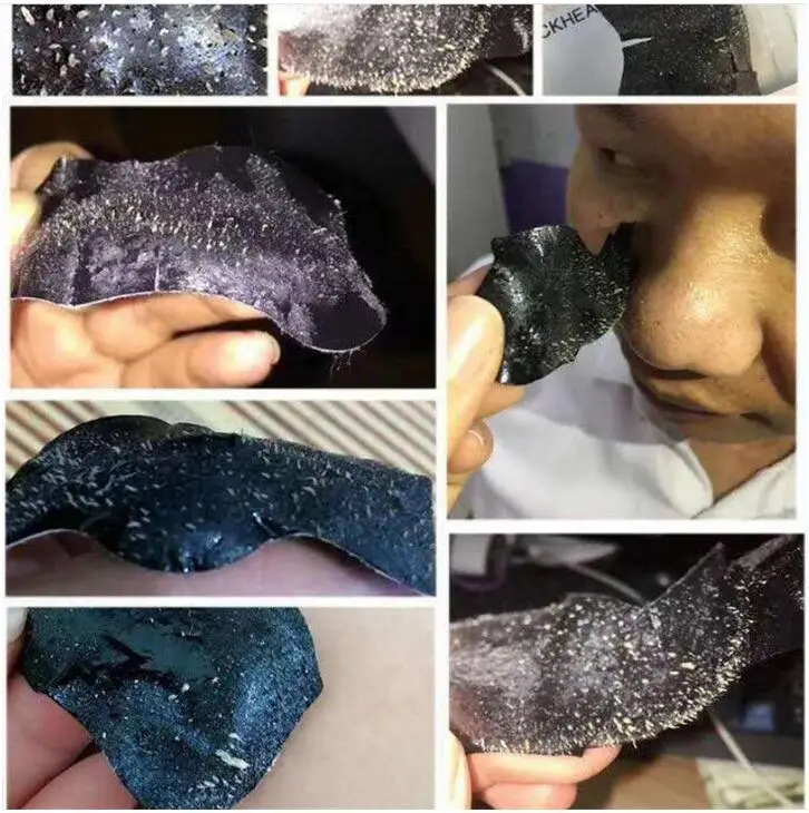 10PCS/bag Bamboo Charcoal Blackhead Removal Mask Peel Nasal Strips ...