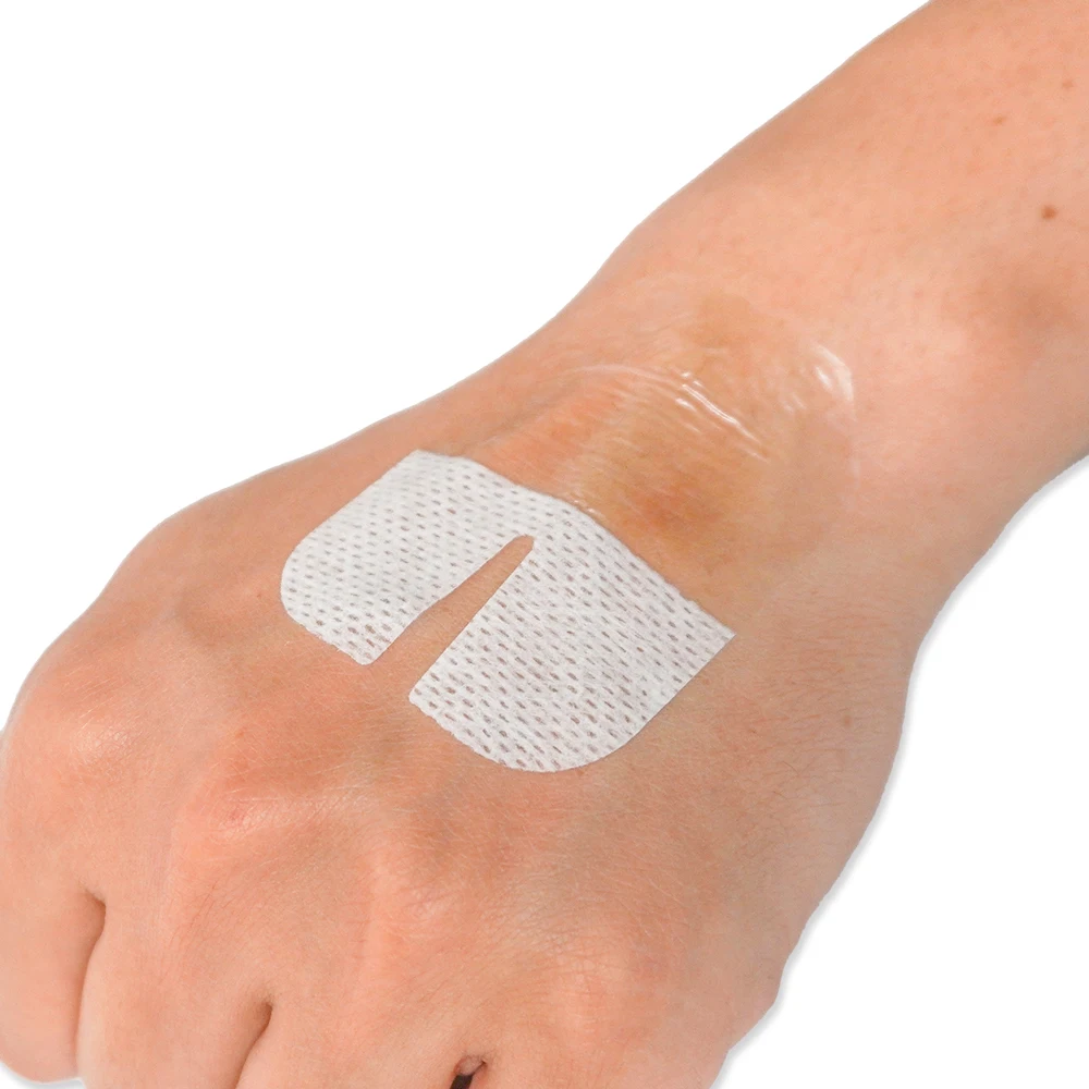 Medical Island Wound Dressing Catheter Fixation Device Transparent Iv ...