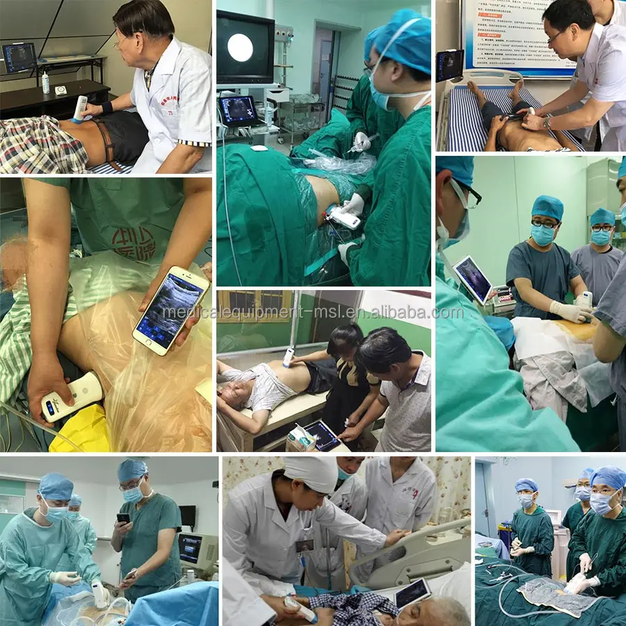 3 in 1 Color Doppler Ultrasound Probe - Versatile & Reliable