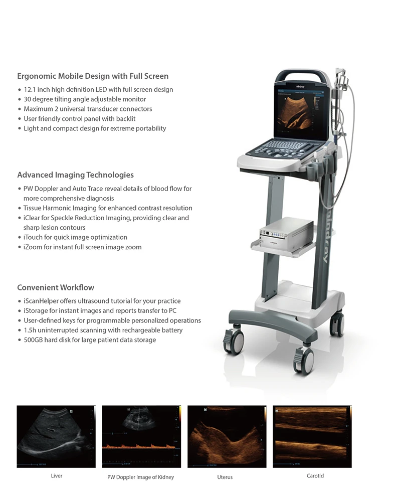 Mindray DP10 Ultrasound - Portable Black and White Scanner
