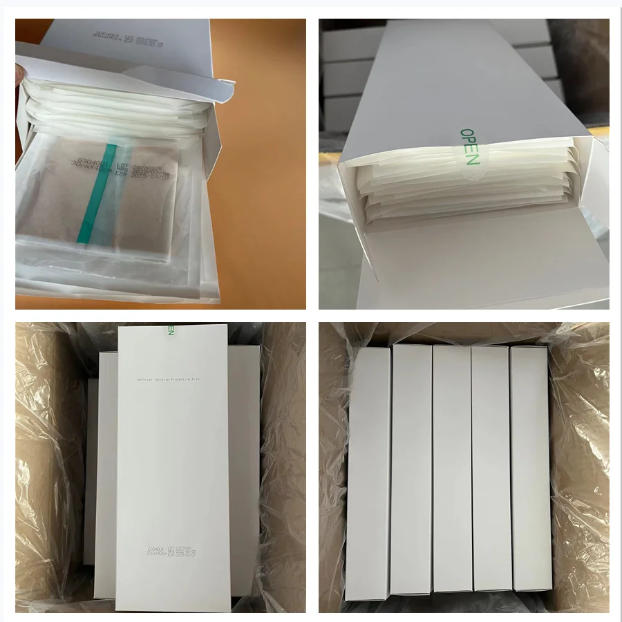 Sterile Negative Pressure Wound Therapy Npwt Dressing Kit Transparent ...