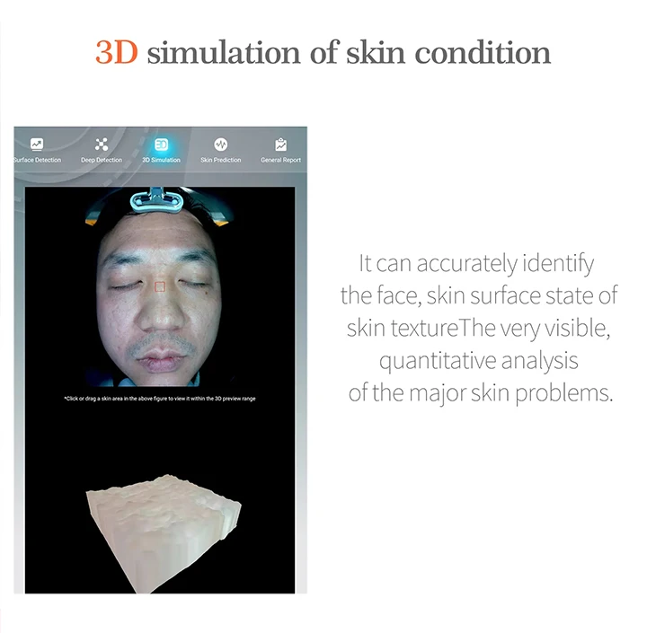 Hottest 3D Face Skin Analyzer - Precision Facial Care
