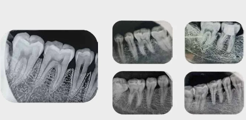 TR310 Dental X Ray Film Scanner - High Definition & Flexible