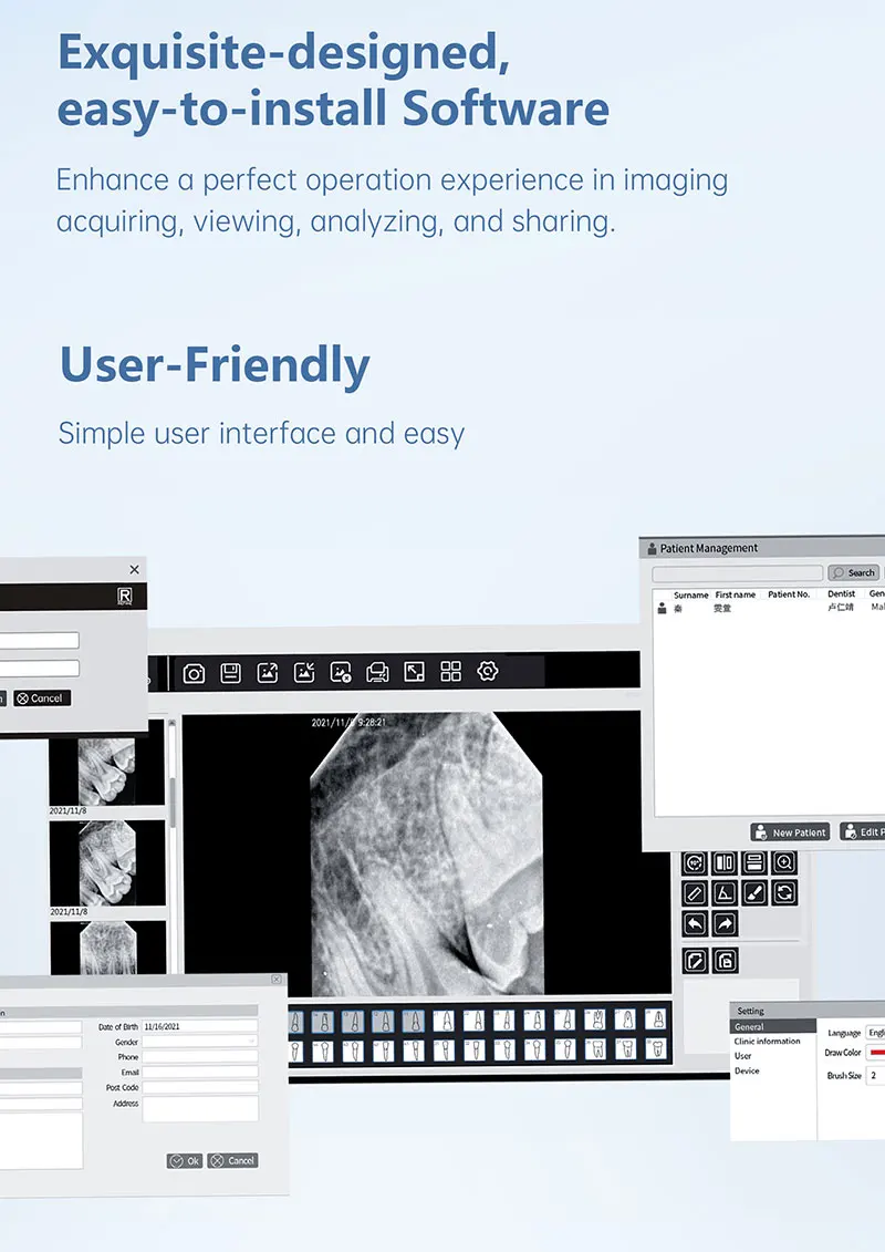 Dental Intraoral X-ray Sensor R1/ R2 Intraoral Digital Imaging System Usb Rvg Imaging Sensor For ...