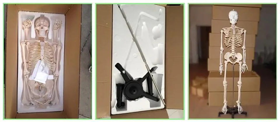 Large Intestine Rectum Pathology Medical Anatomical Model Medical ...