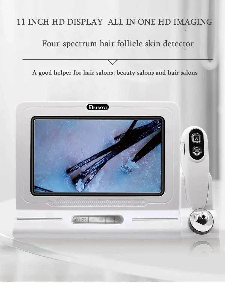 2024 Scalp Scanner Detector Hair Analyzer / Skin And Scalp Hair ...