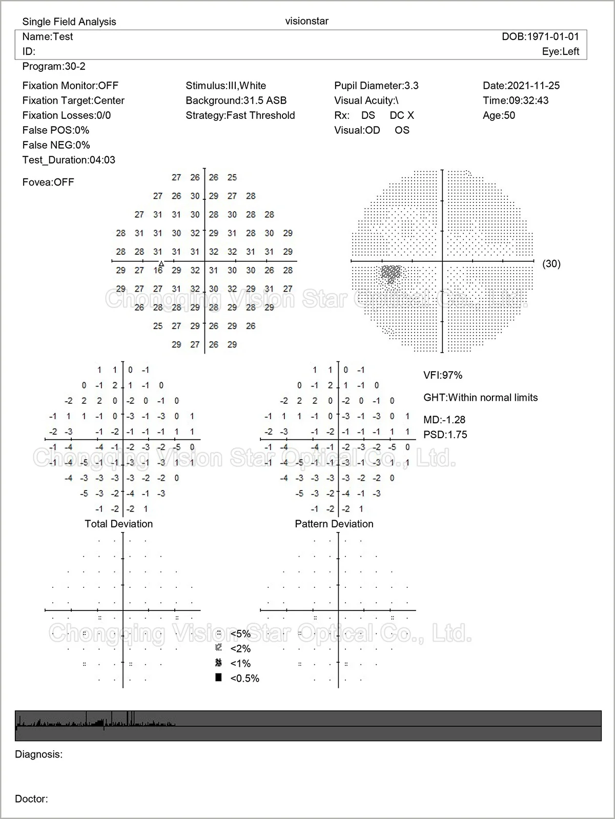 BIO-1000 Hospital Ophthalmic Automated Computer Perimeter Advanced ...