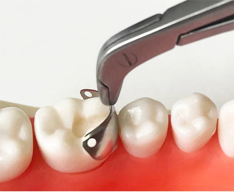 50/pk Dental Sectional Matrix System Refill 3.5mm-6.5mm