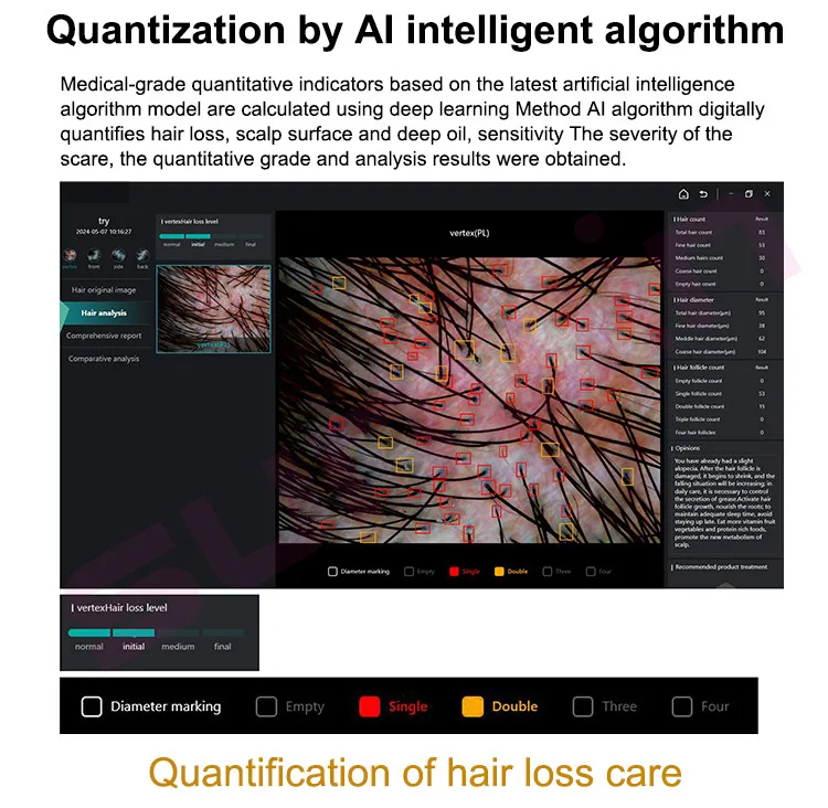 Scalp Examination Hair Follicle Analyzer 16MP HD AI Detection 3-Light ...
