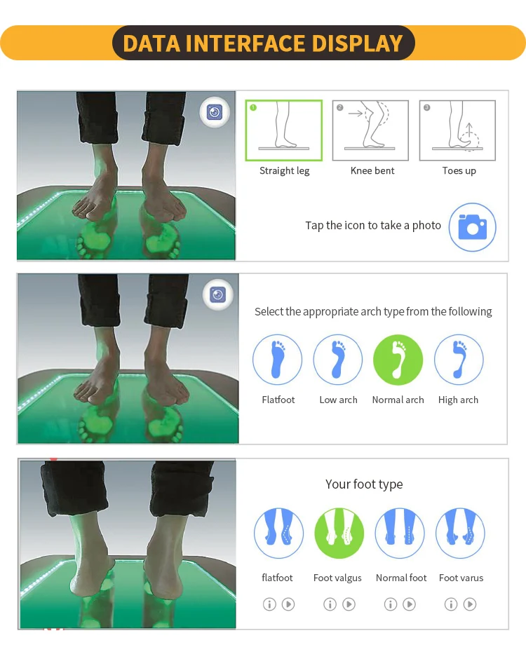3D Foot Scan Instrument for Precise Insole Customization