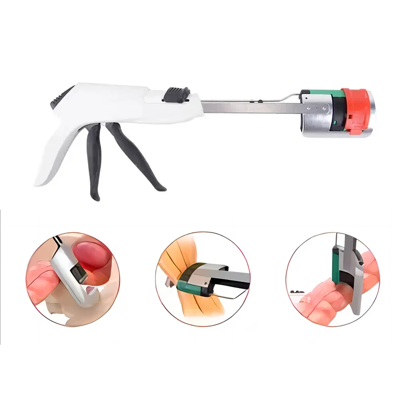 Stomach Laparoscopic Disposable Curved Cutter Stapler - Buy Curved ...