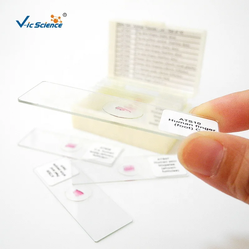 Human Blood Smear Microscope Prepared Slides Onion Biology & Animal ...